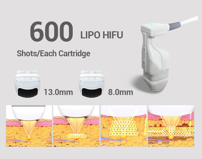 Latest Cryo HIFU - Supreme HIFU - Newangie
